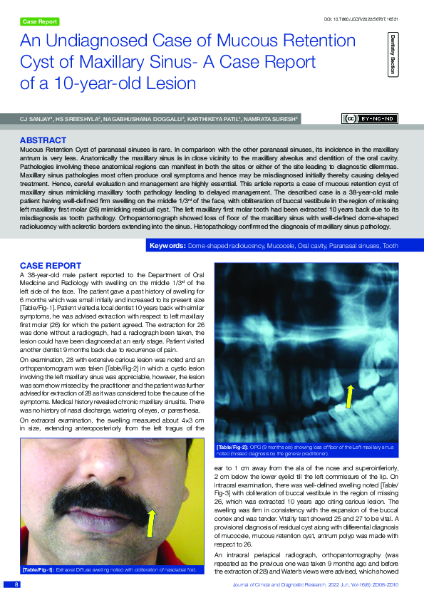 (PDF) An Undiagnosed Case of Mucous Retention Cyst of Maxillary Sinus ...