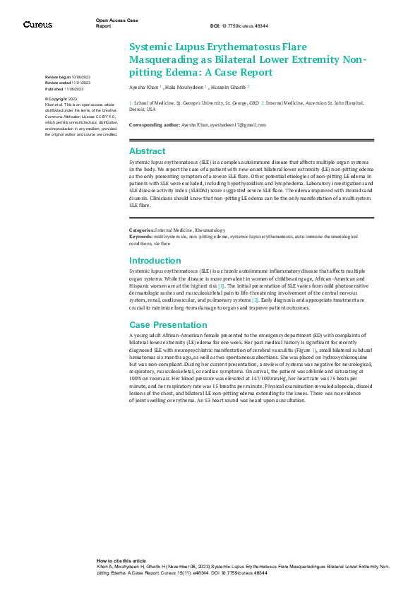 (PDF) Systemic Lupus Erythematosus Flare Masquerading as Bilateral ...