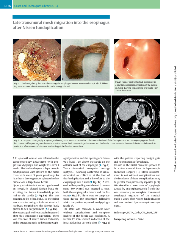 (PDF) Late transmural mesh migration into the esophagus after Nissen fundoplication