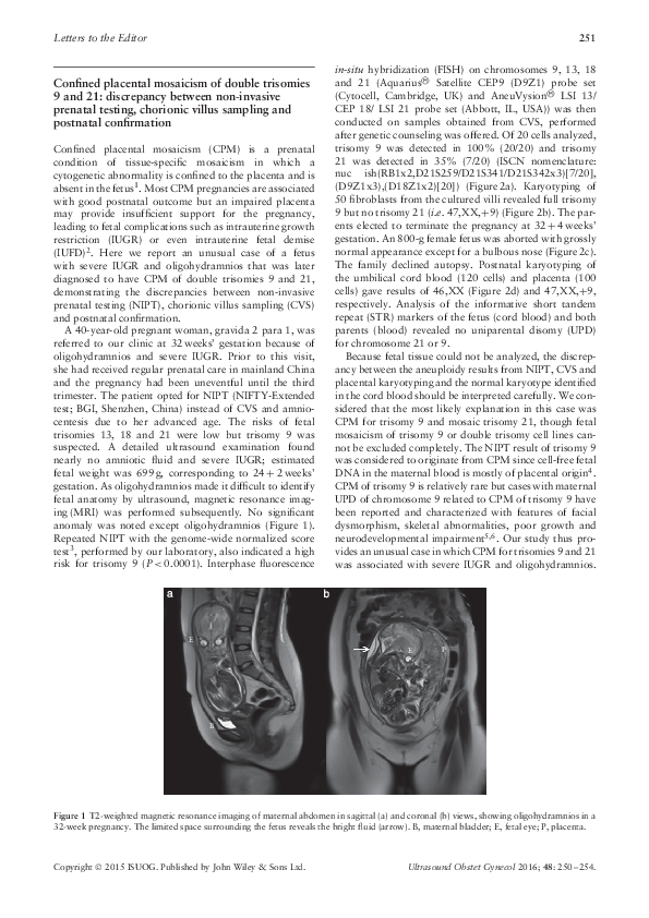 (PDF) Confined placental mosaicism of double trisomies 9 and 21 ...
