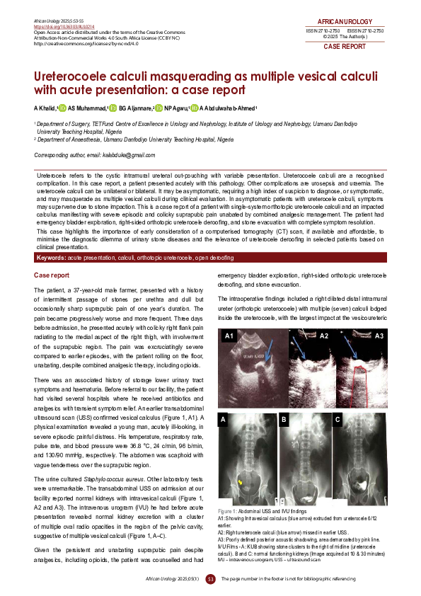 (PDF) Ureterocoele calculi masquerading as multiple vesical calculi ...