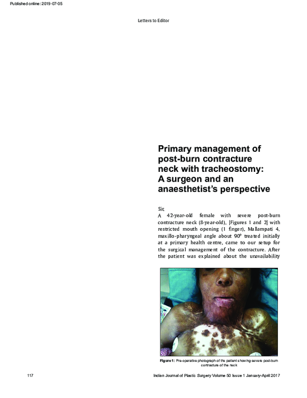 (PDF) Primary management of post-burn contracture neck with ...