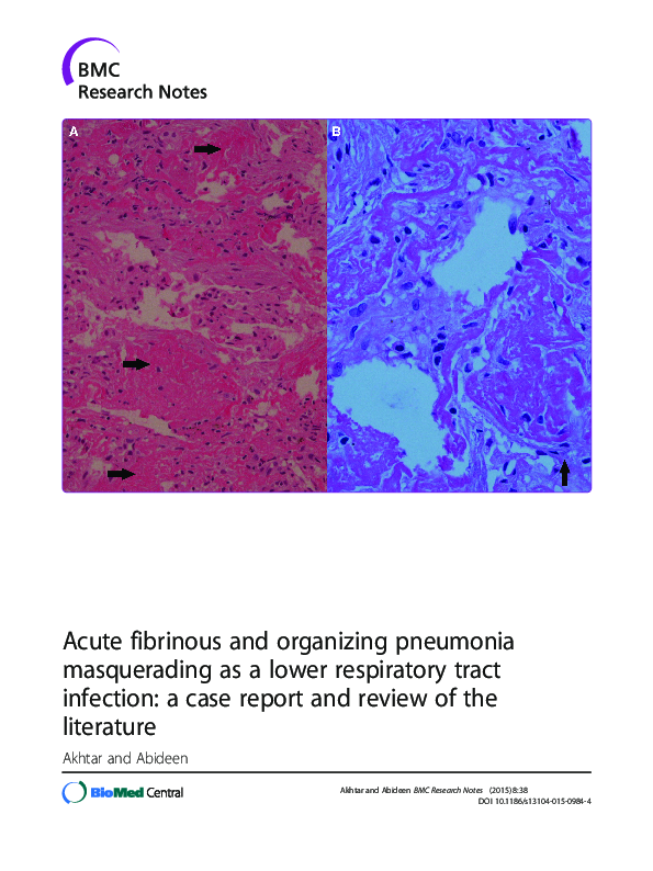 (PDF) Acute fibrinous and organizing pneumonia masquerading as a lower ...