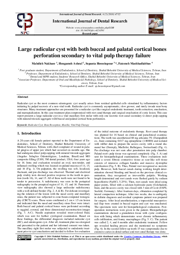 (PDF) Large radicular cyst with both buccal and palatal cortical bones ...
