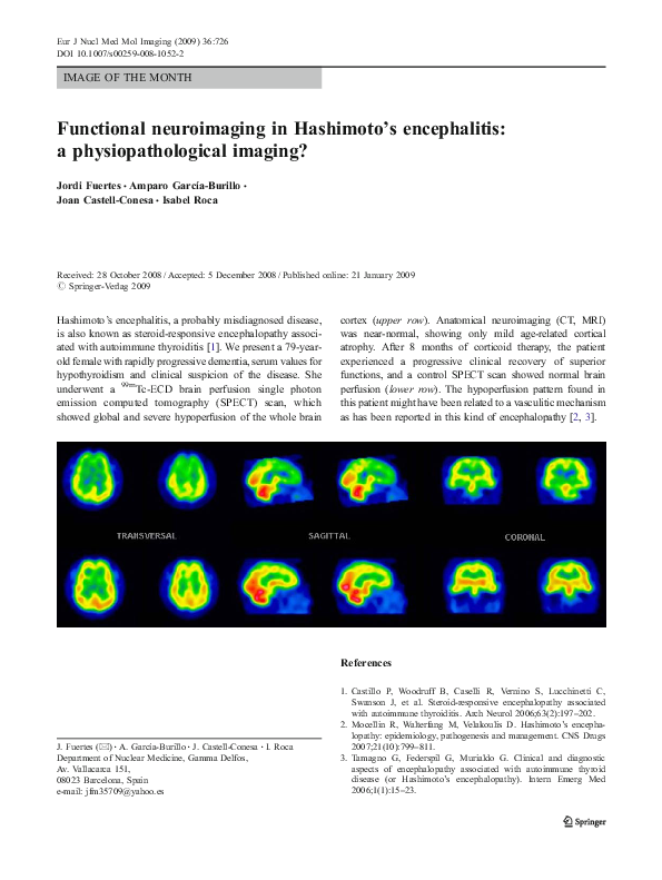 (PDF) Functional neuroimaging in Hashimoto’s encephalitis: a physiopathological imaging?