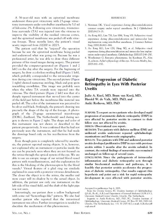 (PDF) Rapid Progression of Diabetic Retinopathy in Eyes With Posterior Uveitis
