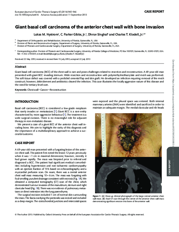 (PDF) Giant basal cell carcinoma of the anterior chest wall with bone ...