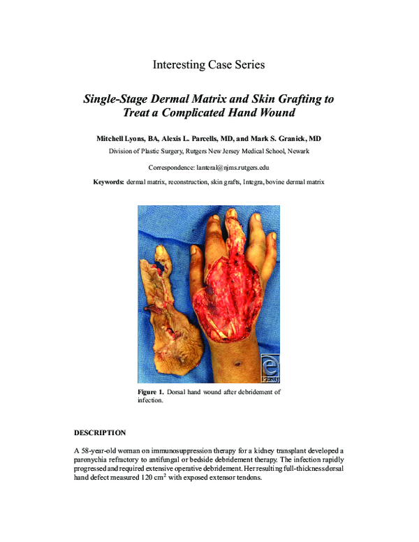 (PDF) Single-Stage Dermal Matrix and Skin Grafting to Treat a ...