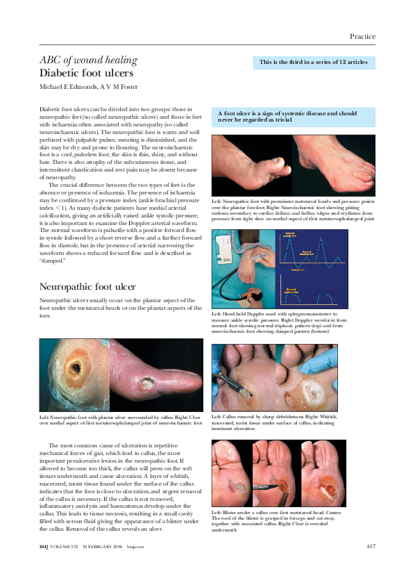 (PDF) Diabetic foot ulcers