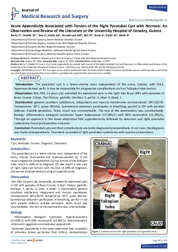 (PDF) Torsion of Right Paratubal Cyst Discovered During Appendectomy ...