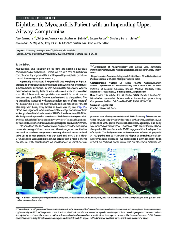 (PDF) Diphtheritic Myocarditis Patient with an Impending Upper Airway ...