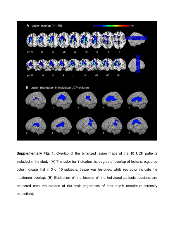 (PDF) Supplementary_Fig._1 – Supplemental material for Mirror Neuron System Activation in ...