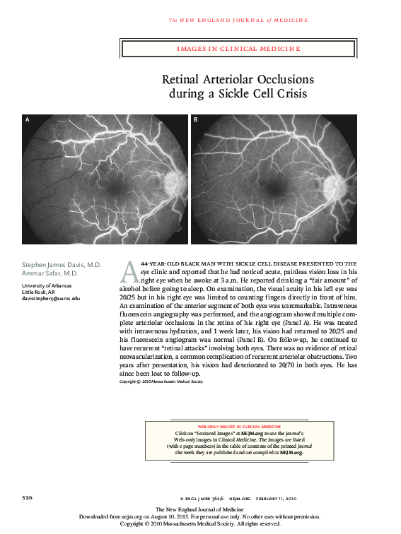 (PDF) Retinal Arteriolar Occlusions during a Sickle Cell Crisis