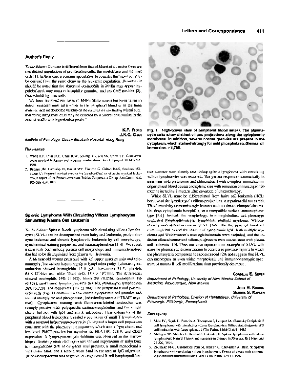 (PDF) Splenic lymphoma with circulating villous lymphocytes = marginal ...