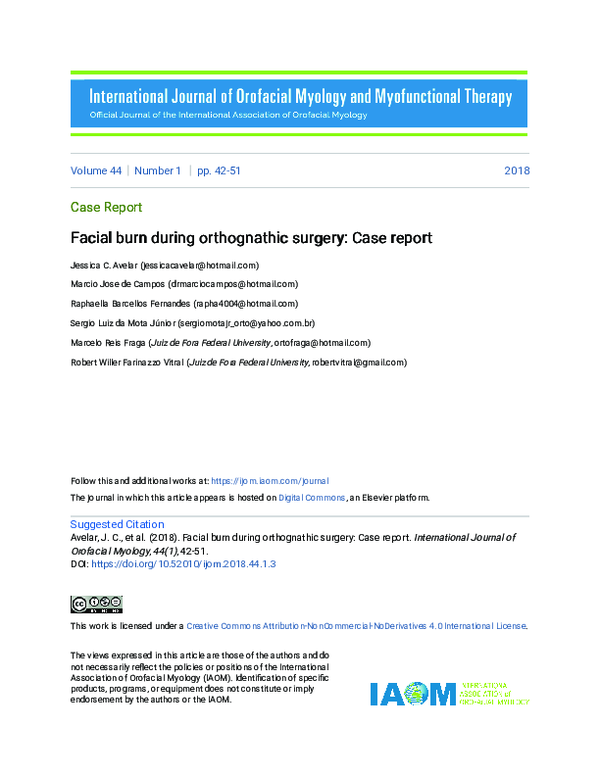 (PDF) Facial burn during orthognathic surgery: Case report