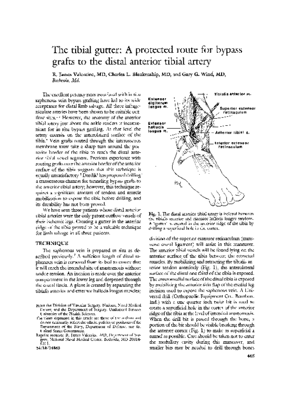 (PDF) The tibial gutter: A protected route for bypass grafts to the ...