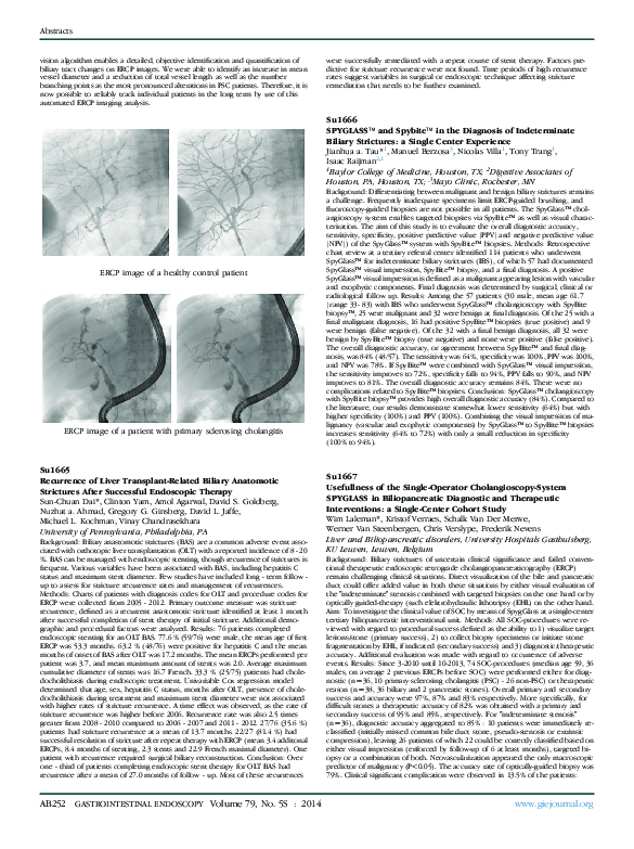 (PDF) Su1666 SPYGLASS™ and Spybite™ in the Diagnosis of Indeterminate ...