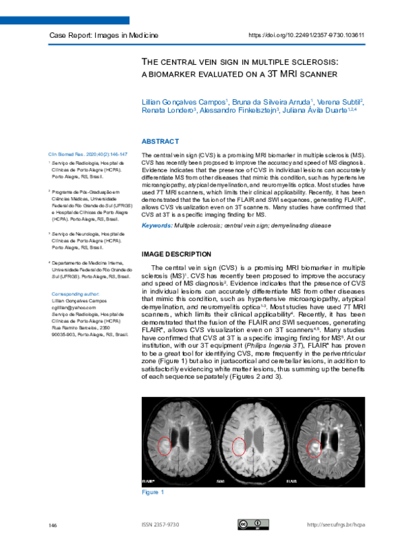 (PDF) The central vein sign in multiple sclerosis: a biomarker ...