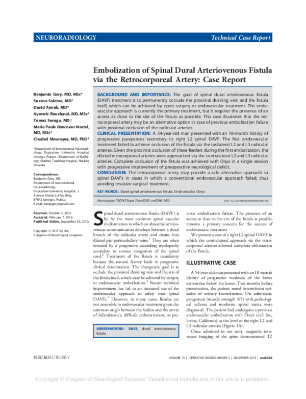 (PDF) Embolization of spinal dural arteriovenous fistulas: importance ...