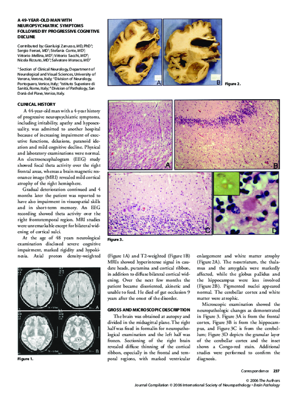 (PDF) A 49-YEAR-OLD Man with Neuropsychiatric Symptoms Followed by ...