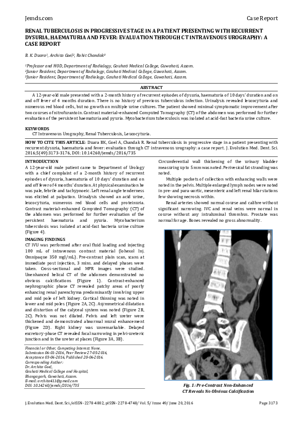 (PDF) Renal Tuberculosis in Progressive Stage in a Patient Presenting ...
