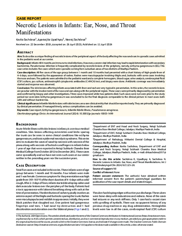 (PDF) Necrotic Lesions in Infants: Ear, Nose, and Throat Manifestations