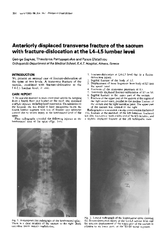 (PDF) Anteriorly displaced transverse fracture of the sacrum with ...