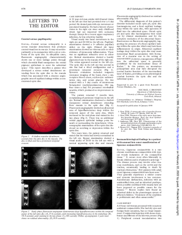 (PDF) Lymphocytoma cutis with conjunctival lesions