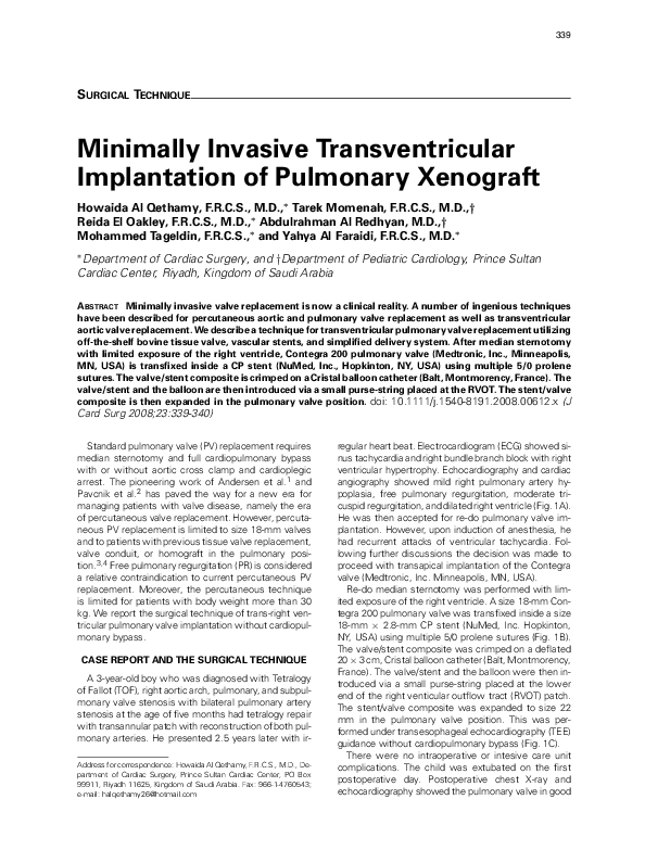 (PDF) Minimally Invasive Transventricular Implantation of Pulmonary ...