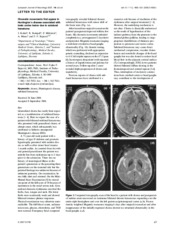 (PDF) Choreatic movements first appear in Huntington's disease ...