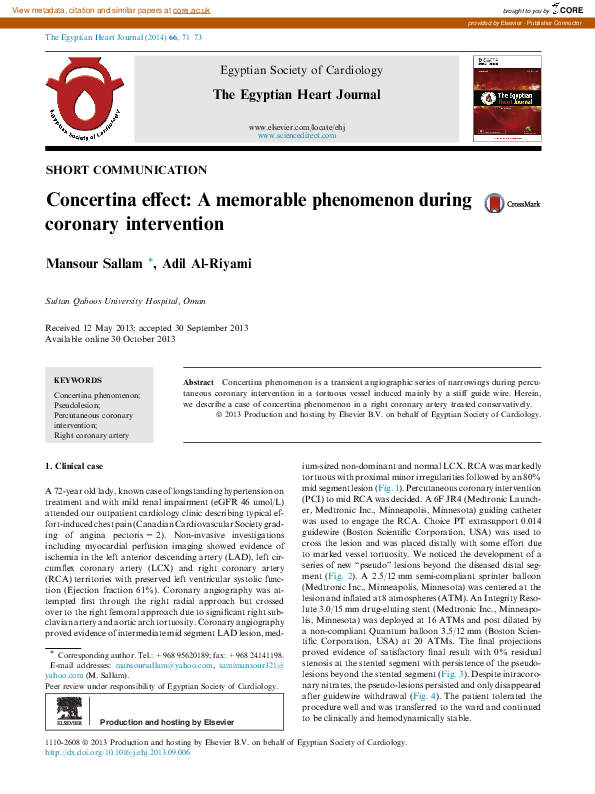 (PDF) Concertina effect: A memorable phenomenon during coronary ...
