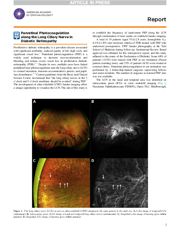 (PDF) Panretinal Photocoagulation along the Long Ciliary Nerve in ...