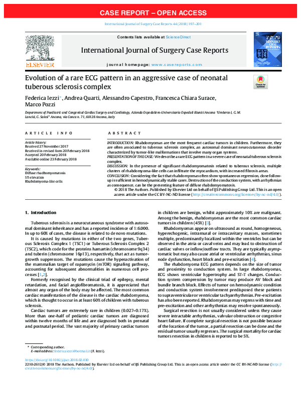 (PDF) Evolution of a rare ECG pattern in an aggressive case of neonatal ...
