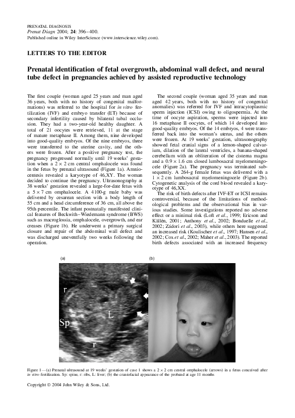 (PDF) Prenatal identification of fetal overgrowth, abdominal wall ...