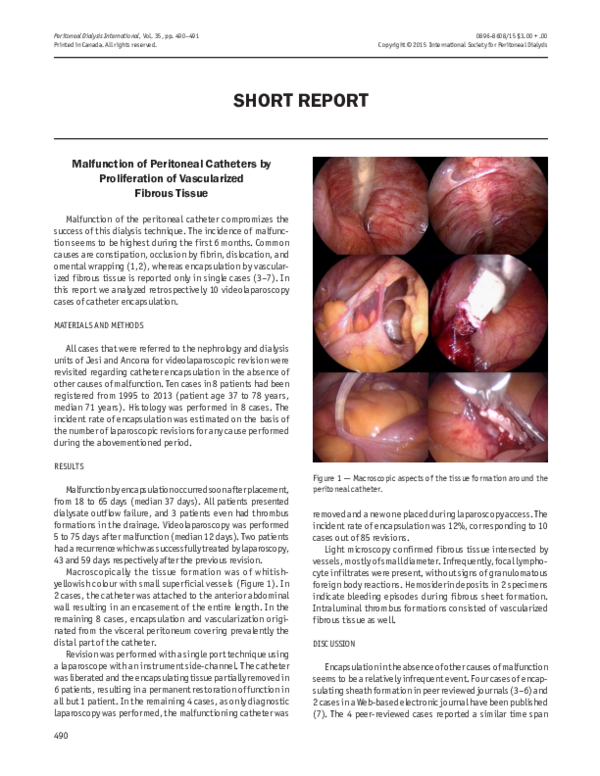 (PDF) Malfunction of Peritoneal Catheters by Proliferation of ...