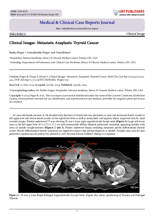 (PDF) Clinical Images-Metastatic Anaplastic Thyroid Cancer