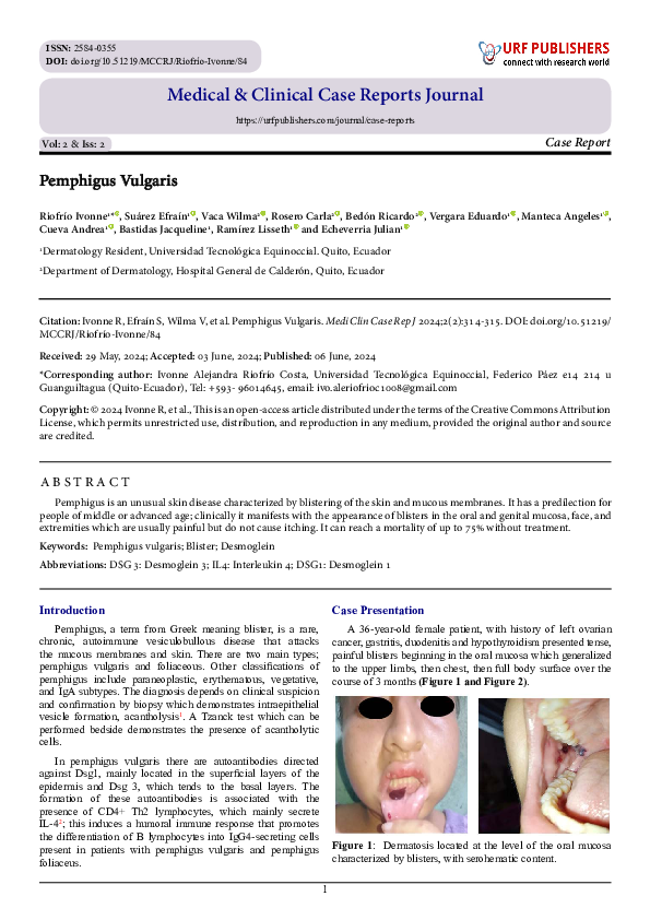 (PDF) Pemphigus Vulgaris
