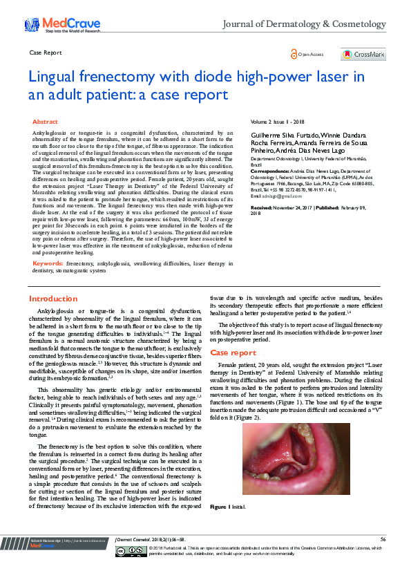 Pdf Lingual Frenectomy With Diode High Power Laser In An Adult