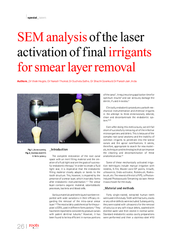 (PDF) SEM analysis of the laser activation of final irrigants for smear ...