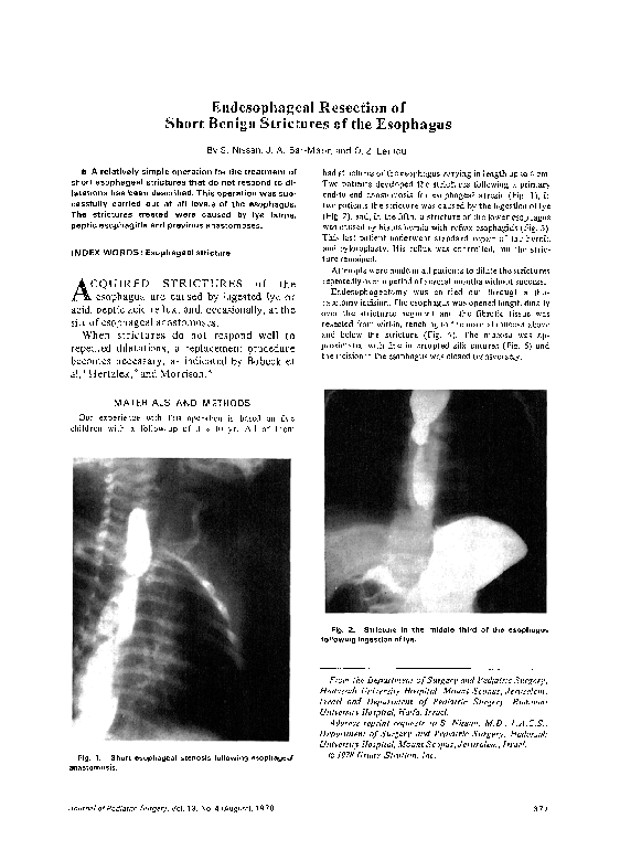 (PDF) Endesophageal resection of short benign strictures of the esophagus