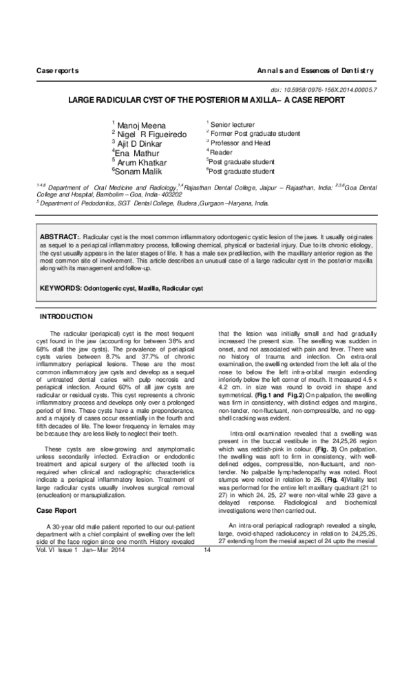 (PDF) Large radicular cyst of the posterior maxilla – a case report