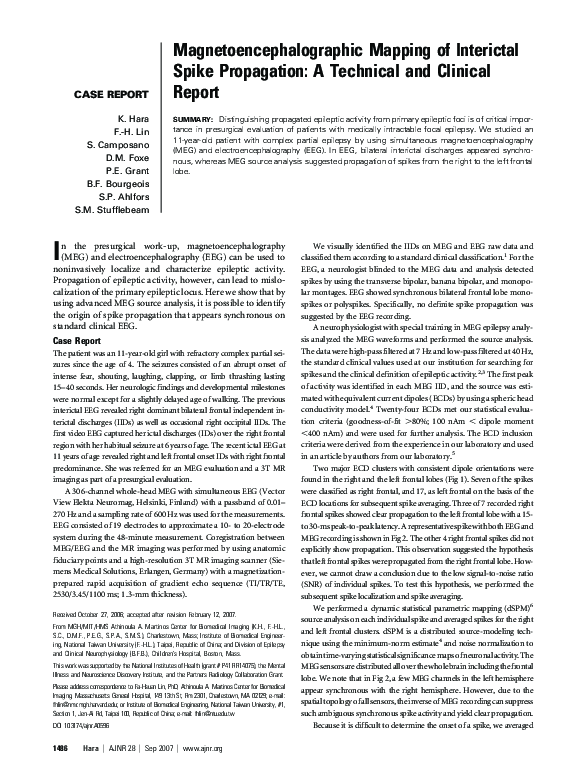 (PDF) Magnetoencephalographic Mapping of Interictal Spike Propagation ...