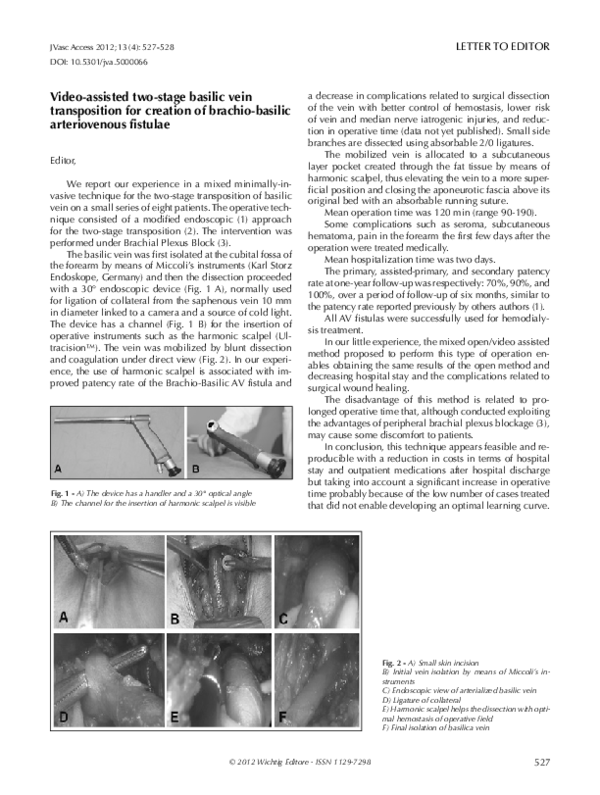 (PDF) Video-assisted two-stage basilic vein transposition for creation ...