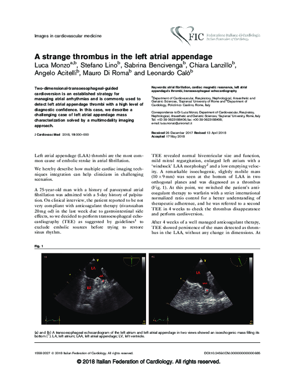 (PDF) A strange thrombus in the left atrial appendage