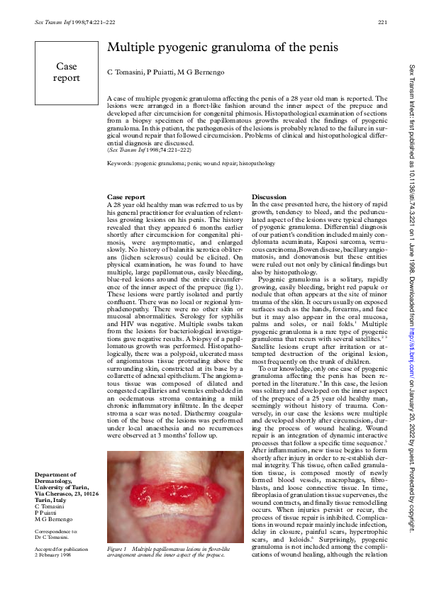 (PDF) Multiple pyogenic granuloma of the penis
