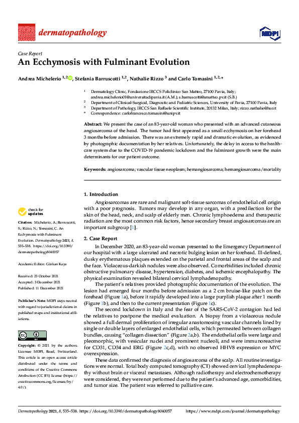 (PDF) An Ecchymosis with Fulminant Evolution