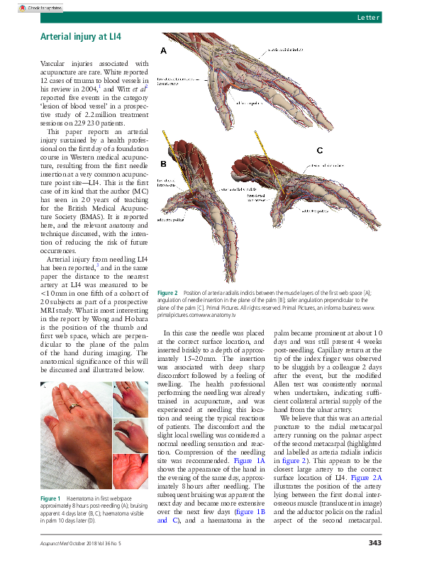 (PDF) Arterial injury at LI4