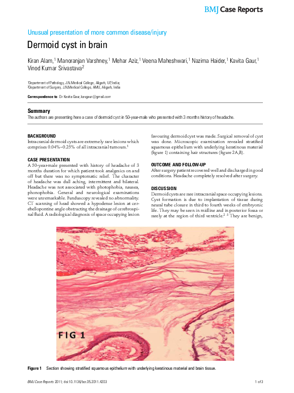 (PDF) Dermoid cyst in brain