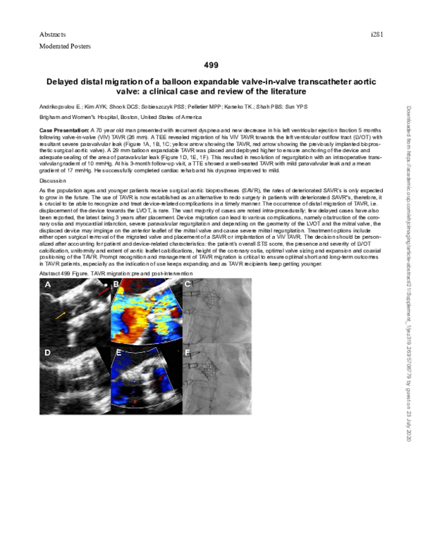 (PDF) 499 Delayed distal migration of a balloon expandable valve-in ...