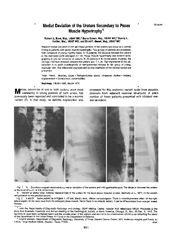 (PDF) Medial Deviation of the Ureters Secondary to Psoas Muscle Hypertrophy